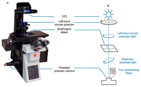 A Novel Polarized Light Microscope For The Examination Of Birefringent Crystals In Synovial Fluid A Novel Polarized Light Microscope For The Examination Of Birefringent Crystals In Synovial Fluid