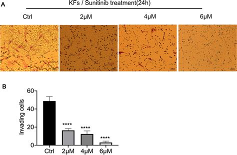 Invasion 3d Migration Assays Transwell Inserts Were Covered In Download Scientific Diagram