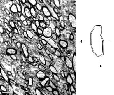 Left The Rules Of The Unbiased Counting Frame All Nerve Fiber