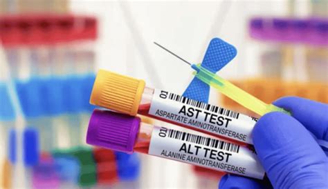 Đo Hoạt Độ Ast Và Alt Là Gì Hướng Dẫn Chi Tiết Về Các Chỉ Số Men Gan