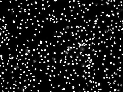 measurement median intensity and setup intensity ratio options button · issue 15