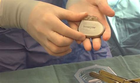 The Bladder Pacemaker A Highly Effective Treatment Only Available In Ontario At Toronto