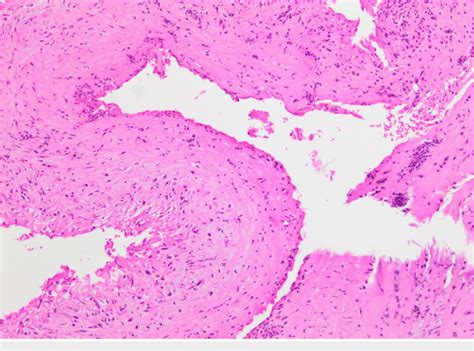 Hande Preparation Of The Cyst Wall 10x Download Scientific Diagram