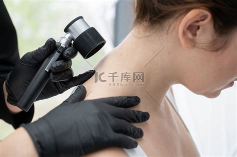 皮肤科医生通过皮肤镜检查患者的痣高清摄影大图 千库网