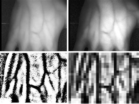 Processing Steps Of The Feature Extraction Algorithm Normal Image