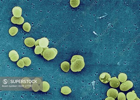 Staphylococcus Aureus Color Ehanced Scanning Electron Micrograph Sem Of Staphylococcus Aureus Staphylococcus Aureus Color Ehanced Scanning Electron Micrograph Sem Of Staphylococcus Aureus