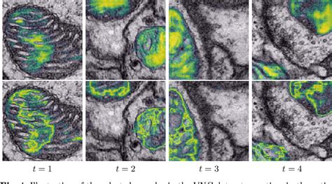 Cost Efficient Segmentation Of Electron Microscopy Images Using Active Learning
