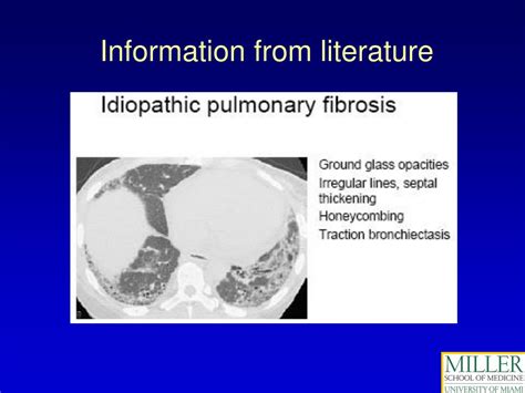Ppt Patient Is A 54yo Female Who Had An Interstitial Pattern On Cxr