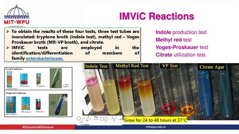 Imvic Tests Purpose Procedure Principle Results And 56 Off