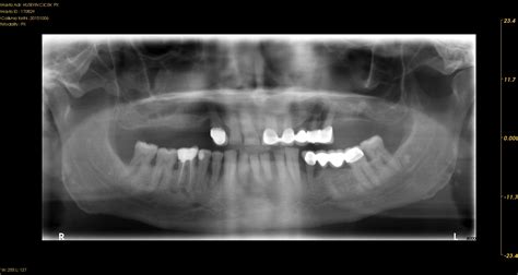 Models Object Detection Dataset By Serkan Yldz