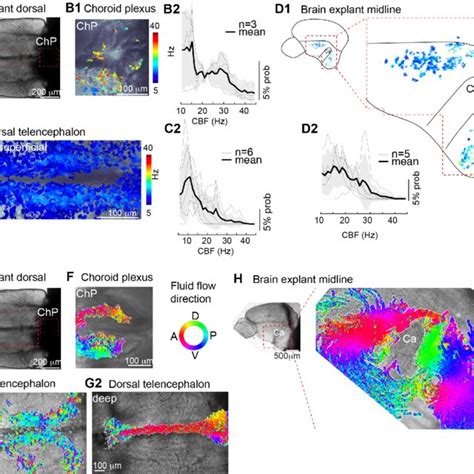Pdf Diversity And Function Of Motile Ciliated Cell Types Within Ependymal Lineages Of The