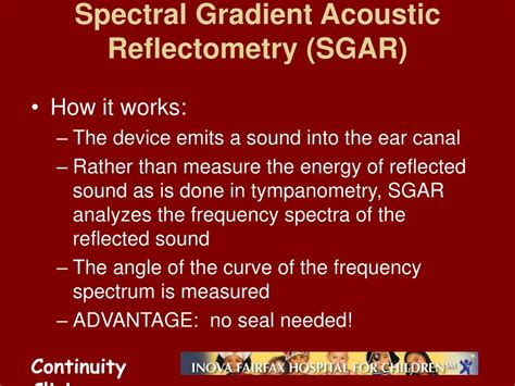 Ppt Tympanometry Powerpoint Presentation Free Download Id647193