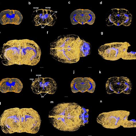 Perivascular And Ventricle Segmentations The Pvs Gold And The Download Scientific Diagram
