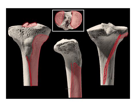 Tibia Head Quiz