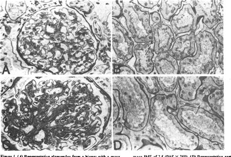 Structure Of Glomerular Mesangium Semantic Scholar