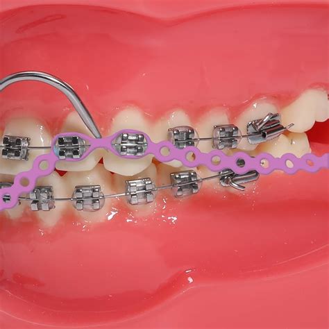 Braces Chain Colors Continuous Power Chains Cx Orthodontic Supply