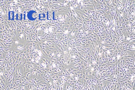 HCMEC D3 人脑微血管内皮细胞永生化 上海葵赛生物科技有限公司Shanghai QuiCell Biotechnology Co Ltd