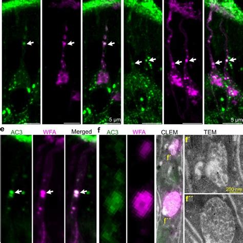 Characterization Of Mvts And Analysis Of Lectin Staining By Clem A Download Scientific Diagram