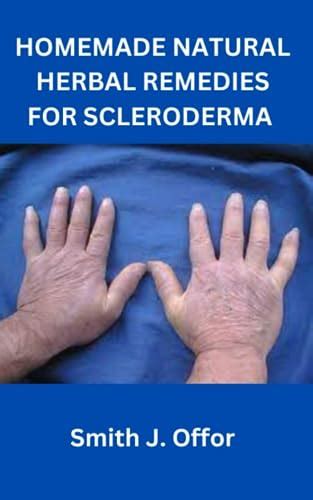 Homemade Natural Herbal Remedies For Scleroderma By Smith J Offor