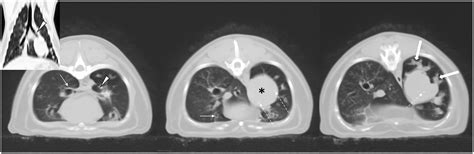 Ct Features Of Feline Cystic Bronchiectasis Forming Mass Lesions