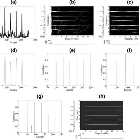 A A Simulated Newborn Eeg Signal Filtered By A High Pass Filter With Download Scientific