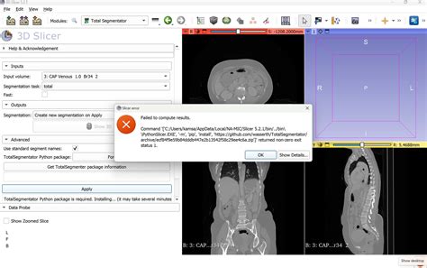 Total Segmentator Issue Support 3d Slicer Community