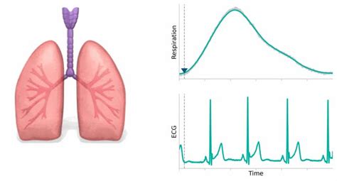 Video Arturo Moncada Torres On Linkedin Biomedicalengineer Ecg Python