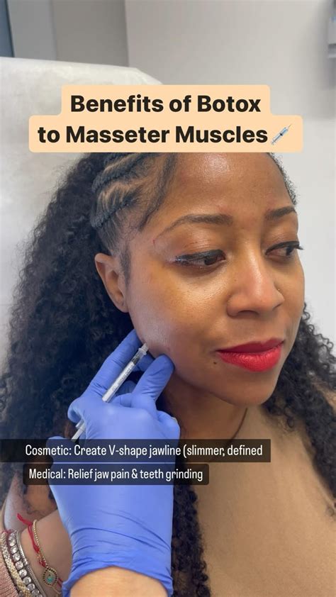 Masseter Botox To Define Jawline Facial Fillers Botox Botox Face
