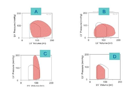 Patho Test 2 Diagram Quizlet