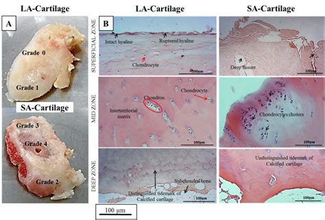 A Gross Tissue Grading Based On The Dougados Classification System