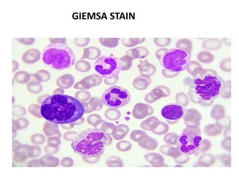 Basic Staining Techniques In Hematology Pptx Blood Disorders Diseases And Conditions
