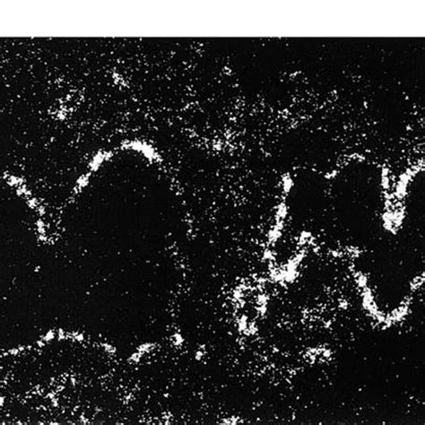 C Myc Expression Induces Increased Proliferation In Transgenic Sbm Download Scientific Diagram