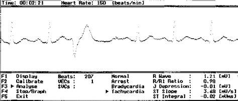 Figure 2 From A Real Time Personal Computer Based System For Analysis