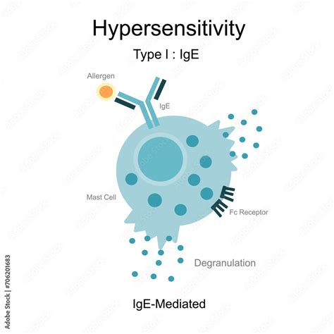 The Diagram Of Hypersensitivity Type L Ige Immunoglobulin E