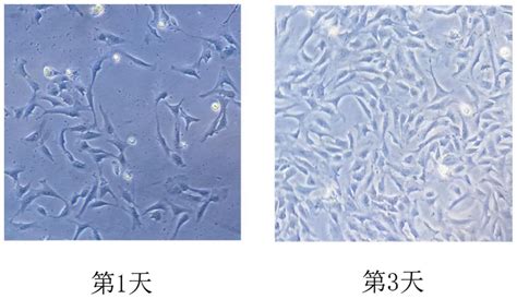 一种成纤维细胞的原代分离培养方法