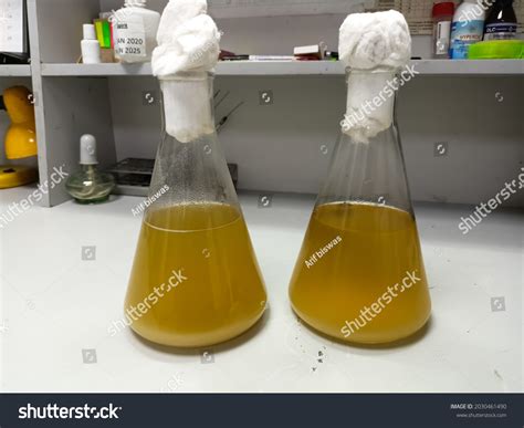 Erlenmeyer Flask Microbiology At Lynda Tawney Blog Erlenmeyer Flask Microbiology At Lynda Tawney Blog