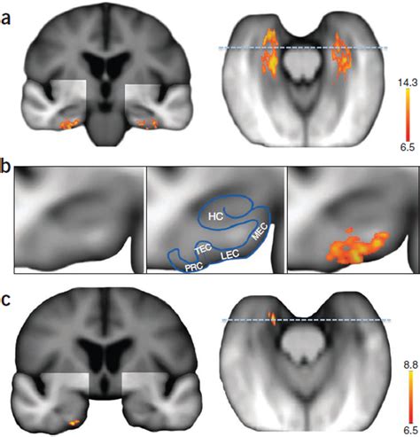 Figure 2 From Molecular Drivers And Cortical Spread Of Lateral Entorhinal Cortex Dysfunction In