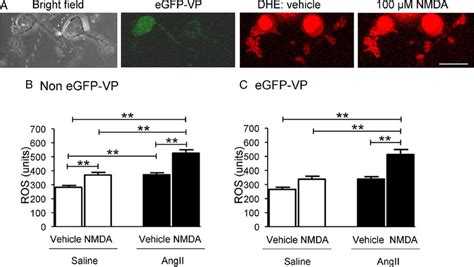 Comparisons Of Baseline Ros Levels And Nmda Triggered Ros Production
