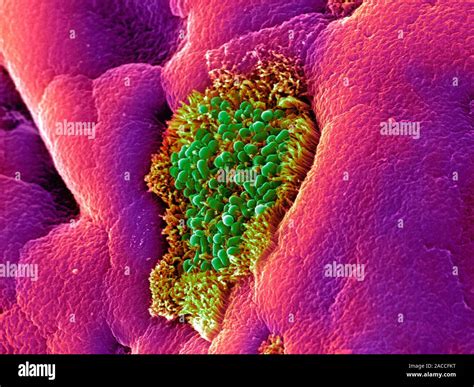E Coli Bacteria Coloured Scanning Electron Micrograph Sem Of Escherichia Coli Bacteria
