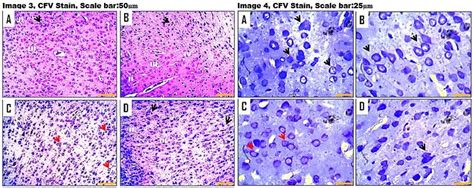 Photomicrographs Showing Panoramic Views Of Prefrontal Cortex Pfc