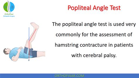Posterior Drawer Test Of The Knee