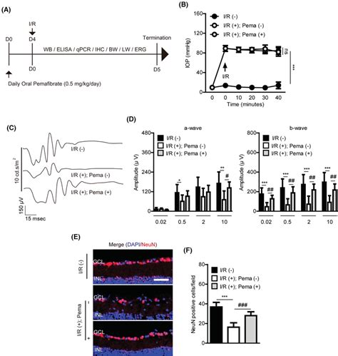 Retinal Damages In A Mouse Model Of Retinal Ischemiareperfusion Ir Retinal Damages In A Mouse Model Of Retinal Ischemiareperfusion Ir