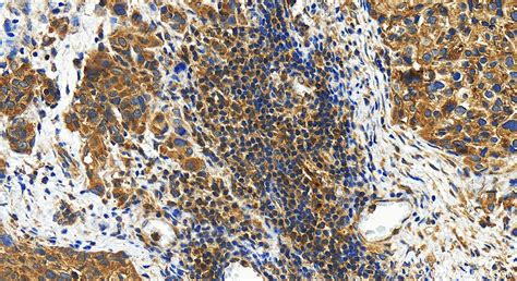 Ldah Antibody 31714 1 Ap Proteintech