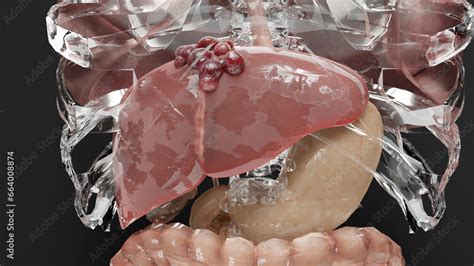 Digestive Organ Liver Cancer Hepatitis Cirrhosis Malignant Tumor