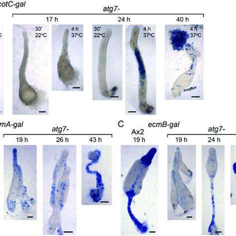 Expression Pattern Of Cell Type Markers In Atg7 Ax2 And Atg7 Cells