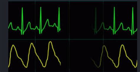 Plot Graph With Graph Library Stmicroelectronics Community