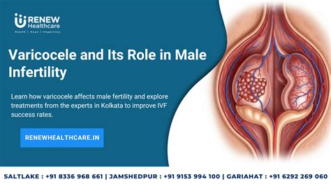 Varicocele And Male Infertility Causes Effects And Treatments