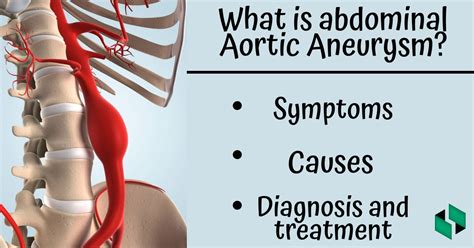 Aortic Aneurysm Symptoms