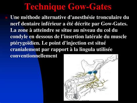Ppt Lanesthésie Locorégionale Powerpoint Presentation Id4423573