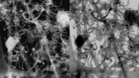 Nanoscience Instruments On Linkedin Scanning Transmission Electron Microscopy